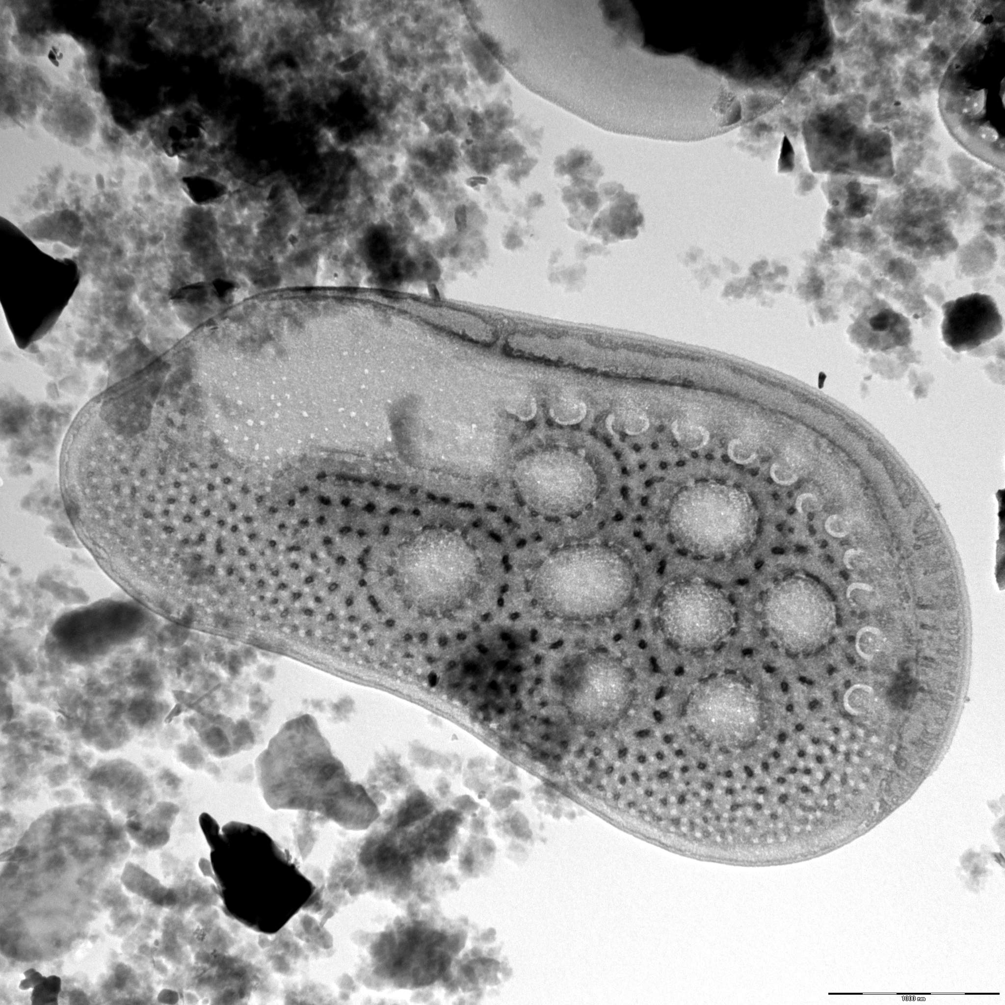 Mallomonas formosa | Silica-scaled chrysophytes of Europe